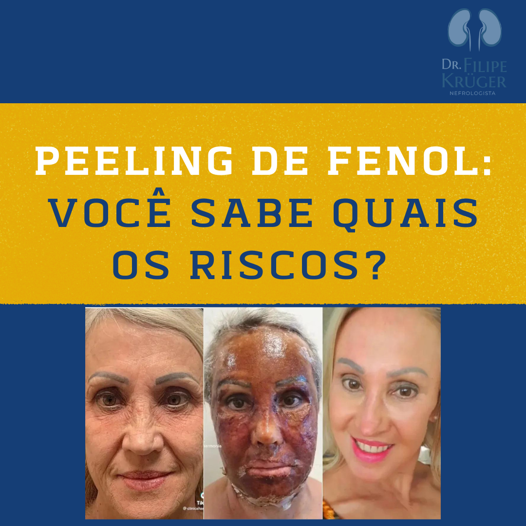 Peeling de fenol: Quais os riscos? - Dr Filipe Krüger